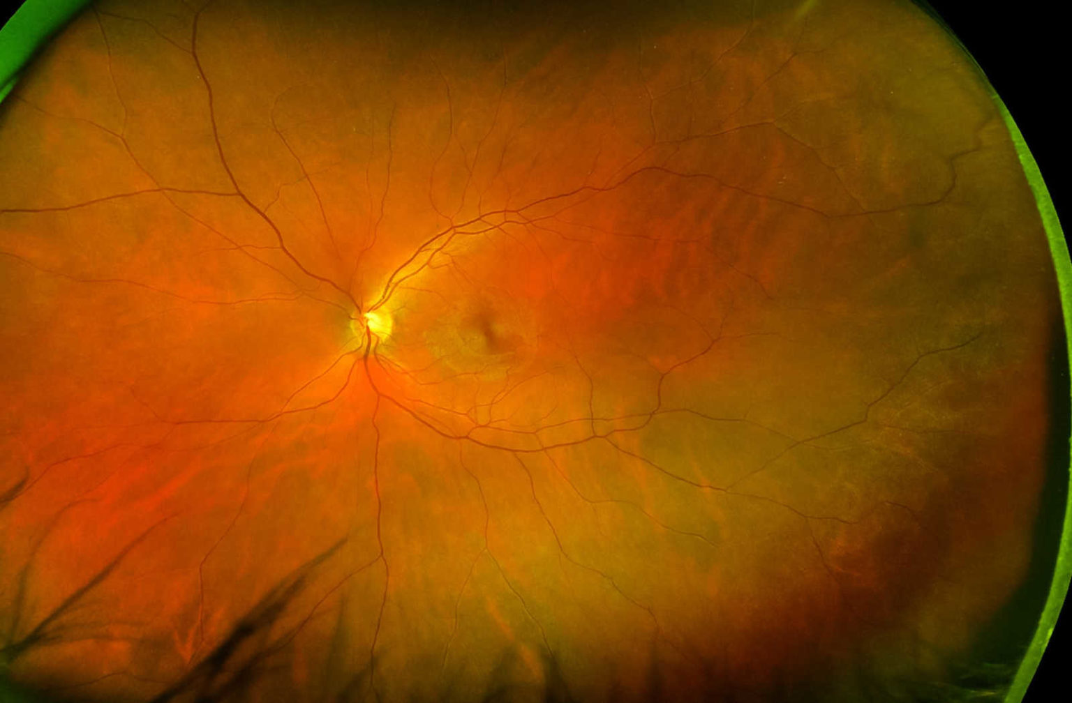 What Does Retinal Imaging Show? | Calgary Family Eye Doctors