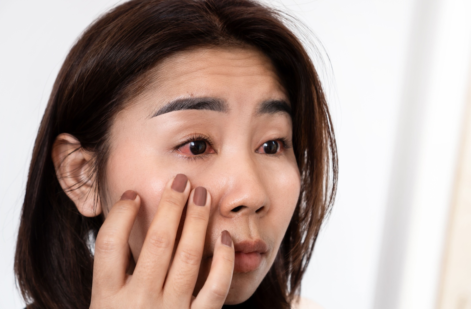 What Is Commonly Misdiagnosed as Pink Eye? | Calgary, AB